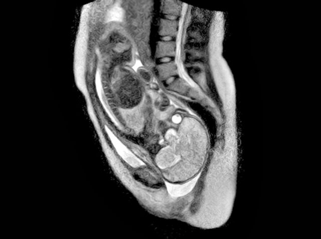 Images of Sex and Birth Inside a MRI Machine (Video) - Third Monk